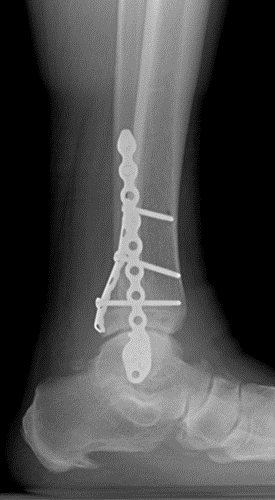 Orthopaedic Surgeon DFW, TX - John Riehl, MD