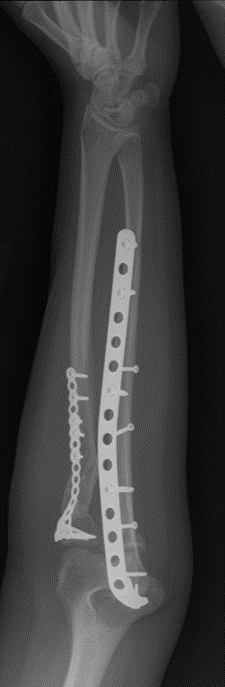 Orthopaedic Surgeon DFW, TX - John Riehl, MD