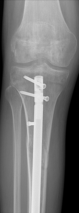 Orthopaedic Surgeon DFW, TX - John Riehl, MD