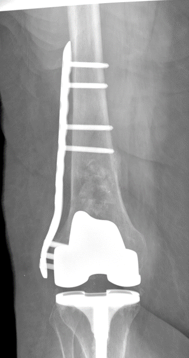 Orthopaedic Surgeon DFW, TX - John Riehl, MD