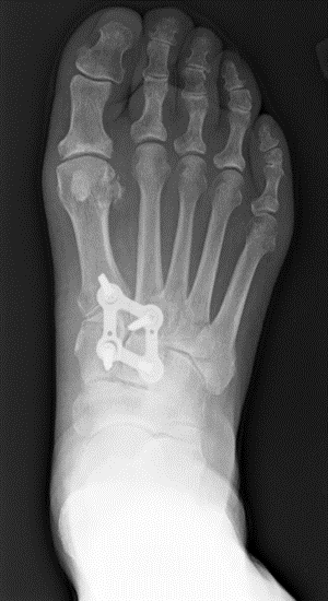 Orthopaedic Surgeon DFW, TX - John Riehl, MD