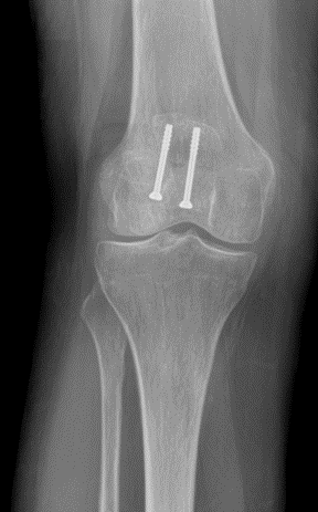 Orthopaedic Surgeon DFW, TX - John Riehl, MD